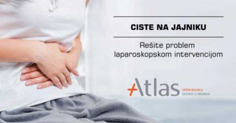 Laparoskopska operacija ciste na jajniku za brži opravak - Vesti online
