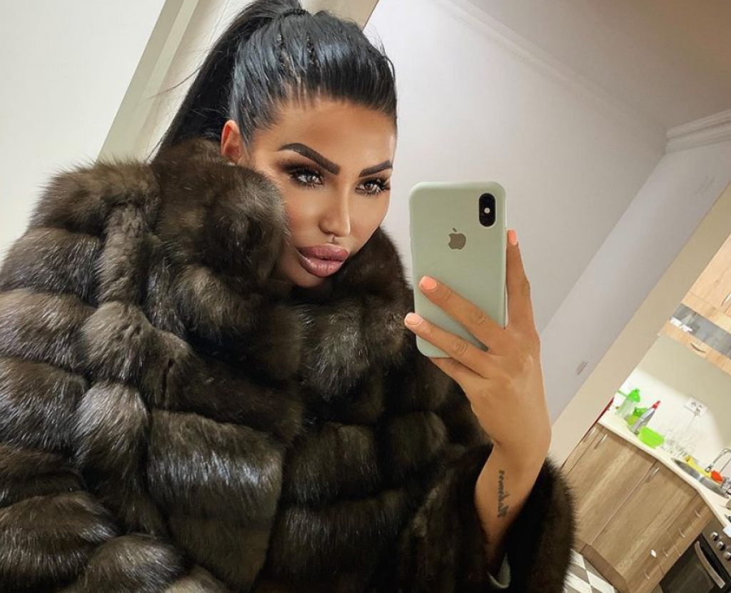 Tijana Ajfon pokazala lice nakon popularnog zahvata, starleta neprepoznatljiva, ništa ne može da ...